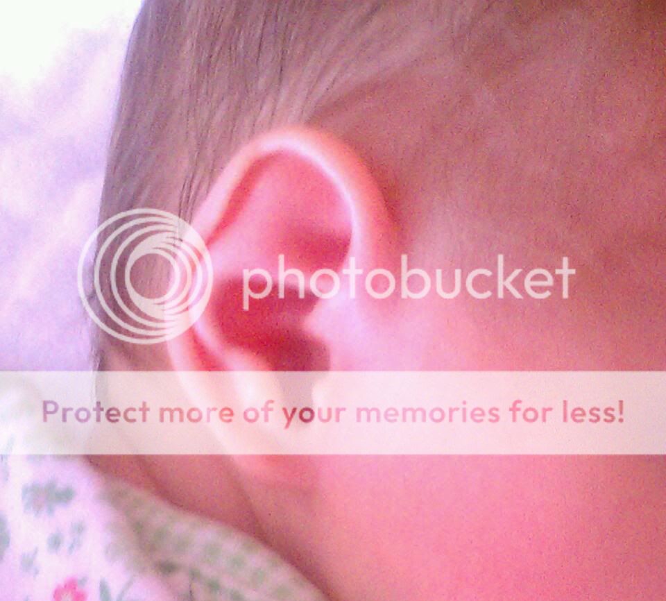 Ear pit & kidney issues | BabyCenter